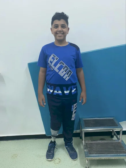 Alaa's Journey of Healing and Hope through the PCRF Amputee Project