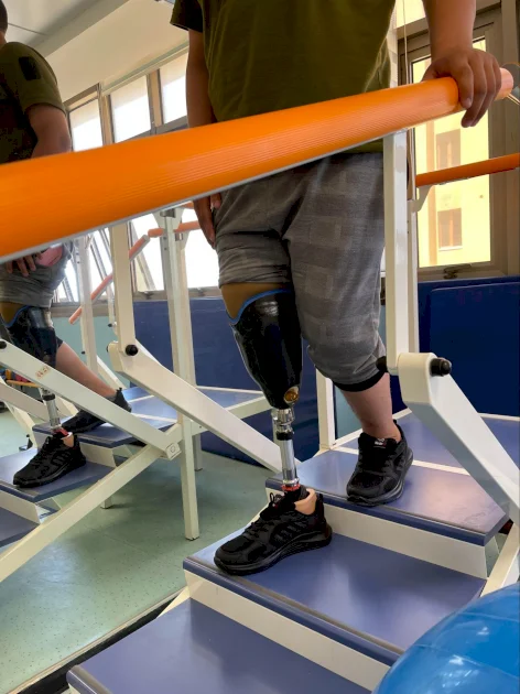 Amputee Project Mohammad Takes His First Steps