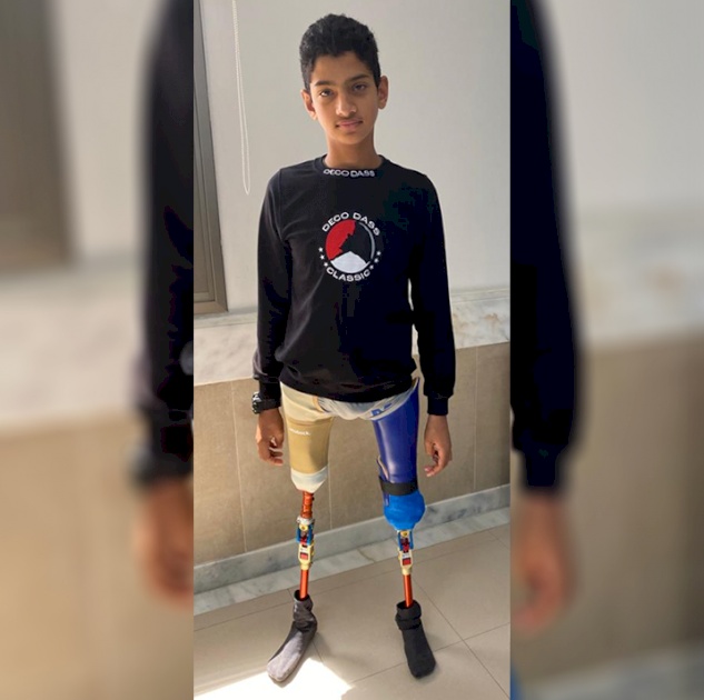 Waseem Receives New Prostheses Through The Amputee Project
