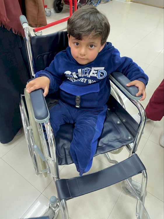 Two Amputee Children Receive Rehabilitation And Prosthesis Treatment